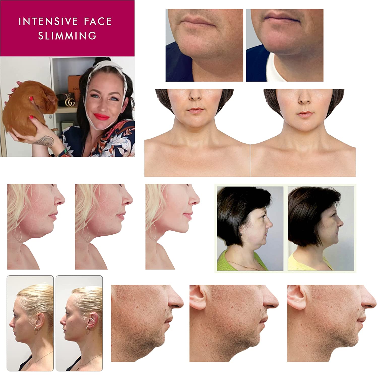 Double Chin Reducer Neck Firming Face Shaping Cheeks Toning Strap and ...