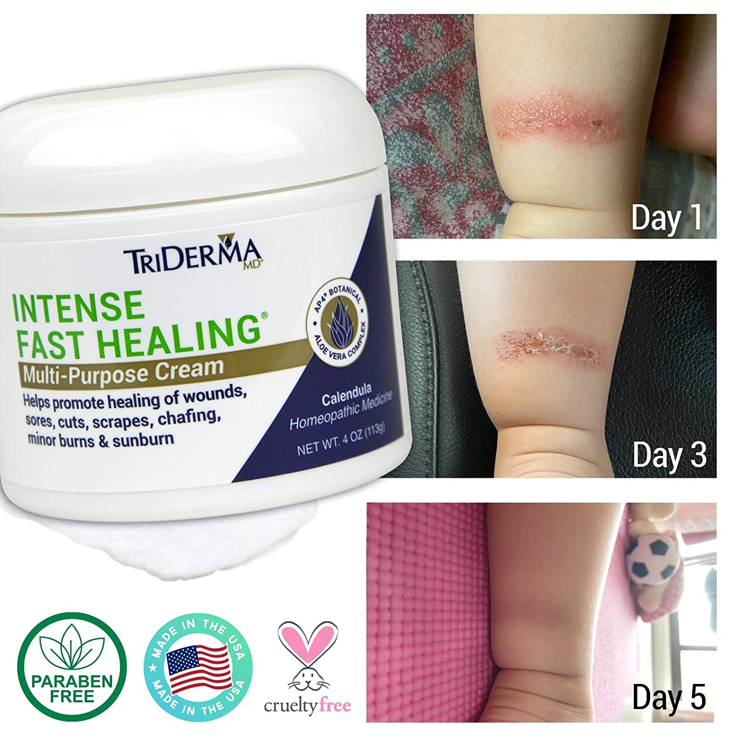 TriDerma Intense Fast Healing Cream, Decreases Healing Time for Minor ...